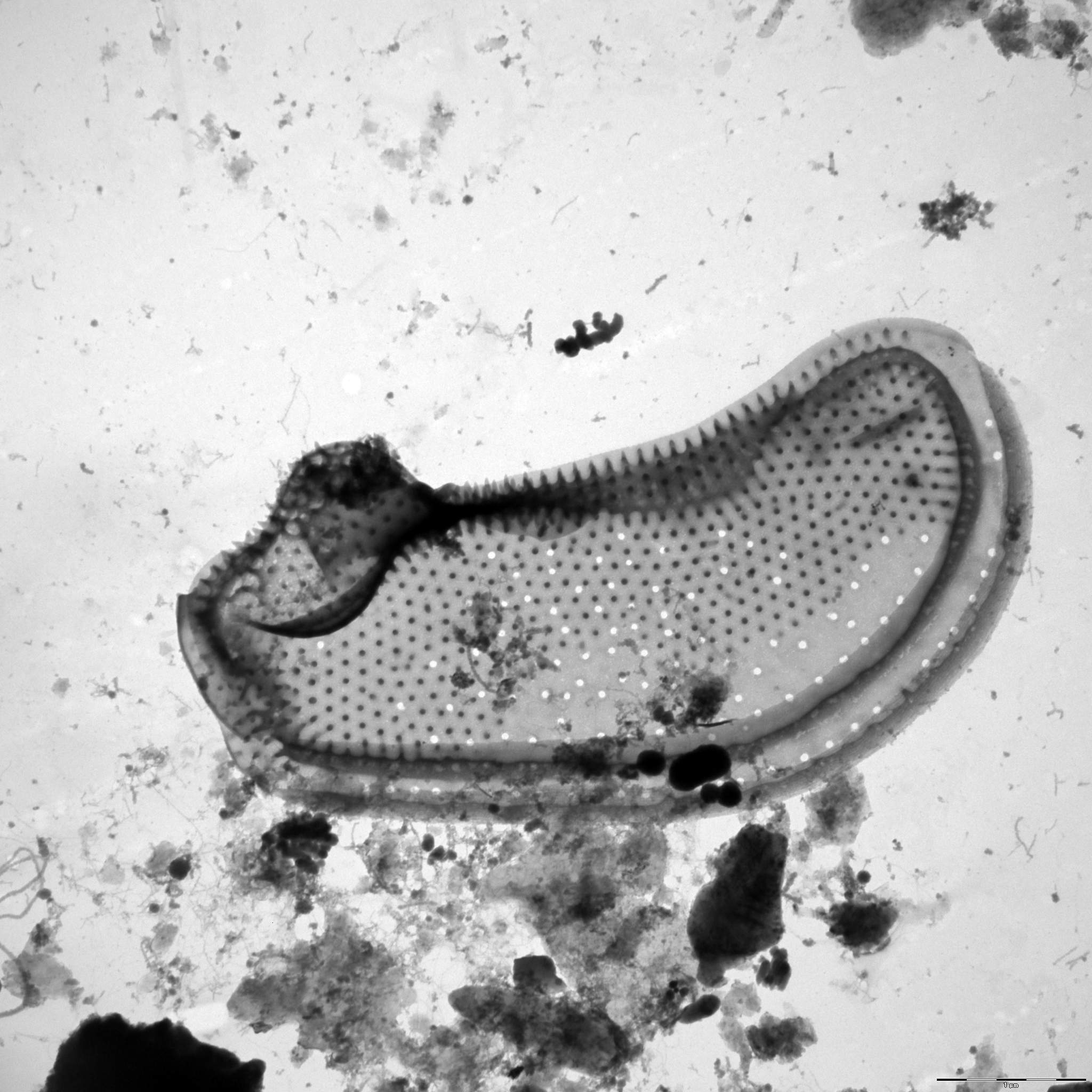 Mallomonas mangofera | Silica-scaled chrysophytes of Europe